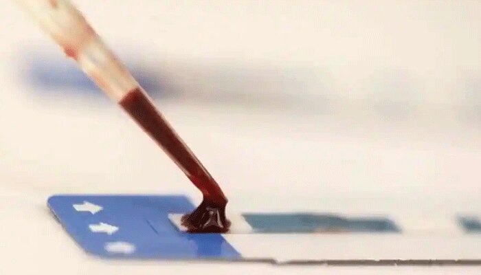 Galleri Blood Test: This single Blood Test can detect 50 types of ...