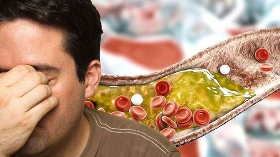 Bad Cholesterol Do You Know The Habits Which Leads To Increase In Bad Bad Cholesterol Do You Know The Habits Which Leads To Increase In Bad