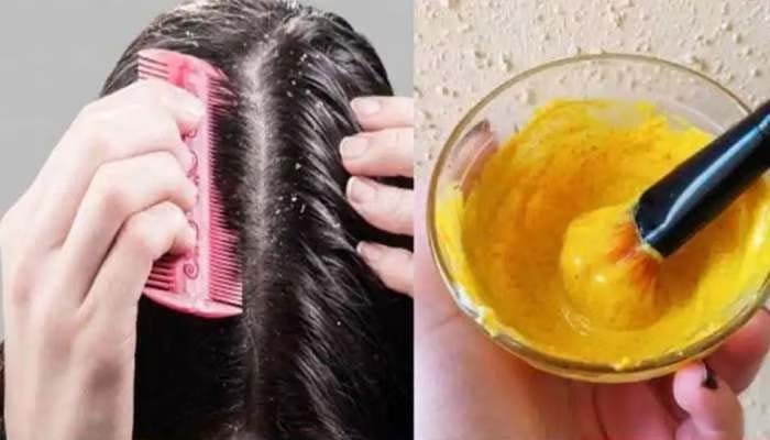 Turmeric Hair Mask benefits while applying turmeric on hair | Turmeric ...