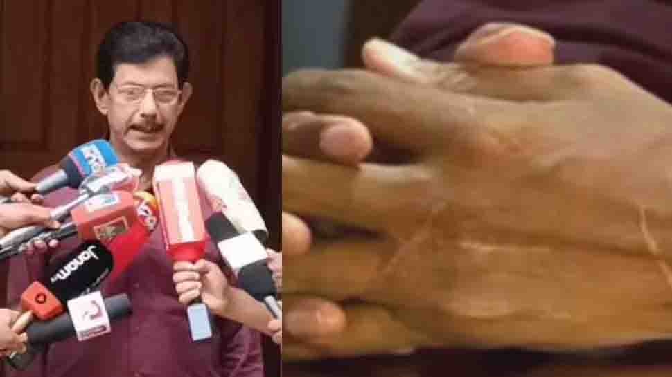 Kerala Hand Chopping Case NIA Nabbed Prime Accused Who Were Absconding ...