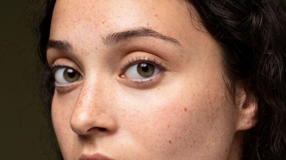 Easy Ways To Remove Darkness From Face Check This Home Remedies easy-ways-to-remove-darkness-from-face-check-this-home-remedies