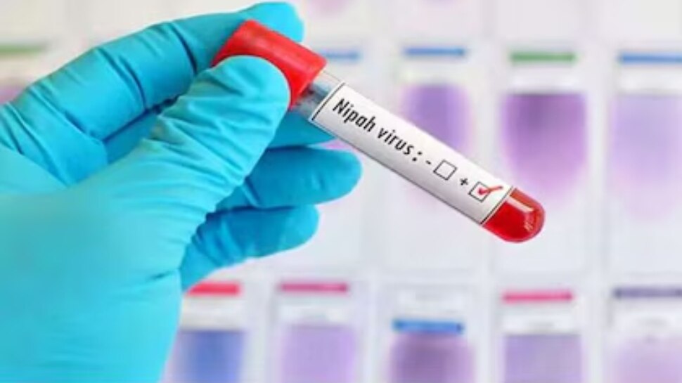Nipah Death Kerala 14 year old boy died after confirmed nipah ... Nipah Death Kerala 14 year old boy died after confirmed nipah ...